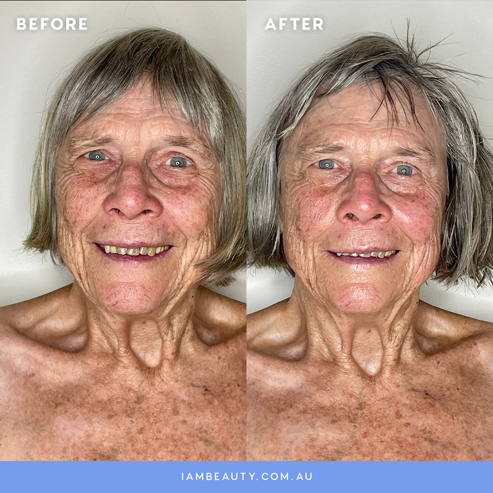 Buccal Massage | Before and After Photos | I Am Beauty